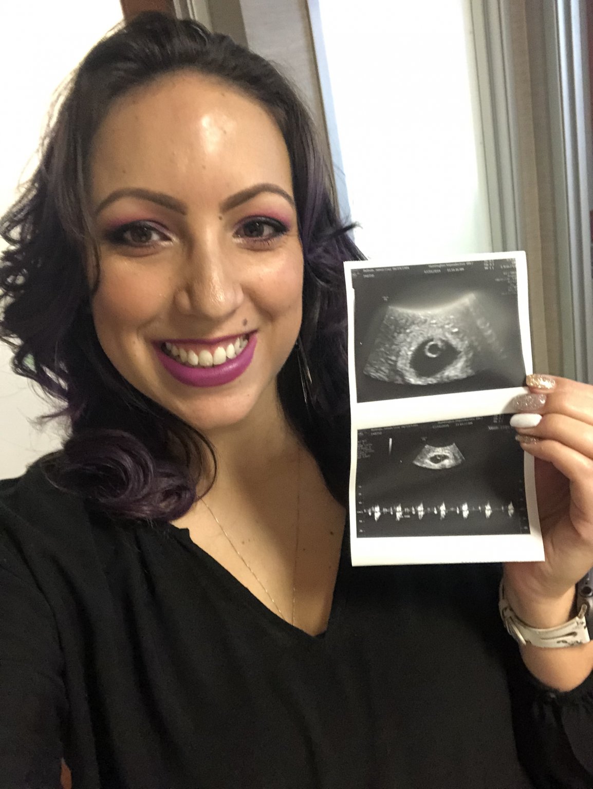 Jamie's Birth Story - Building Families, Inc.